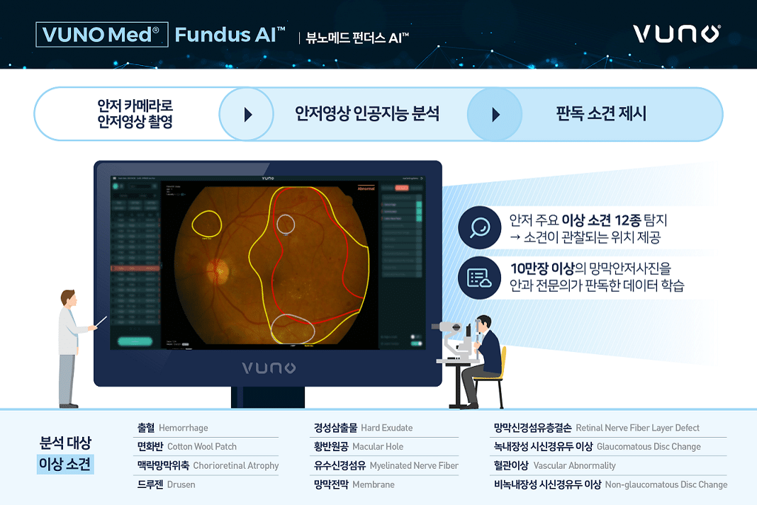 K-BioMed Pioneer: VUNO Med®-Fundus AI™ Becomes Korea's First-ever ...