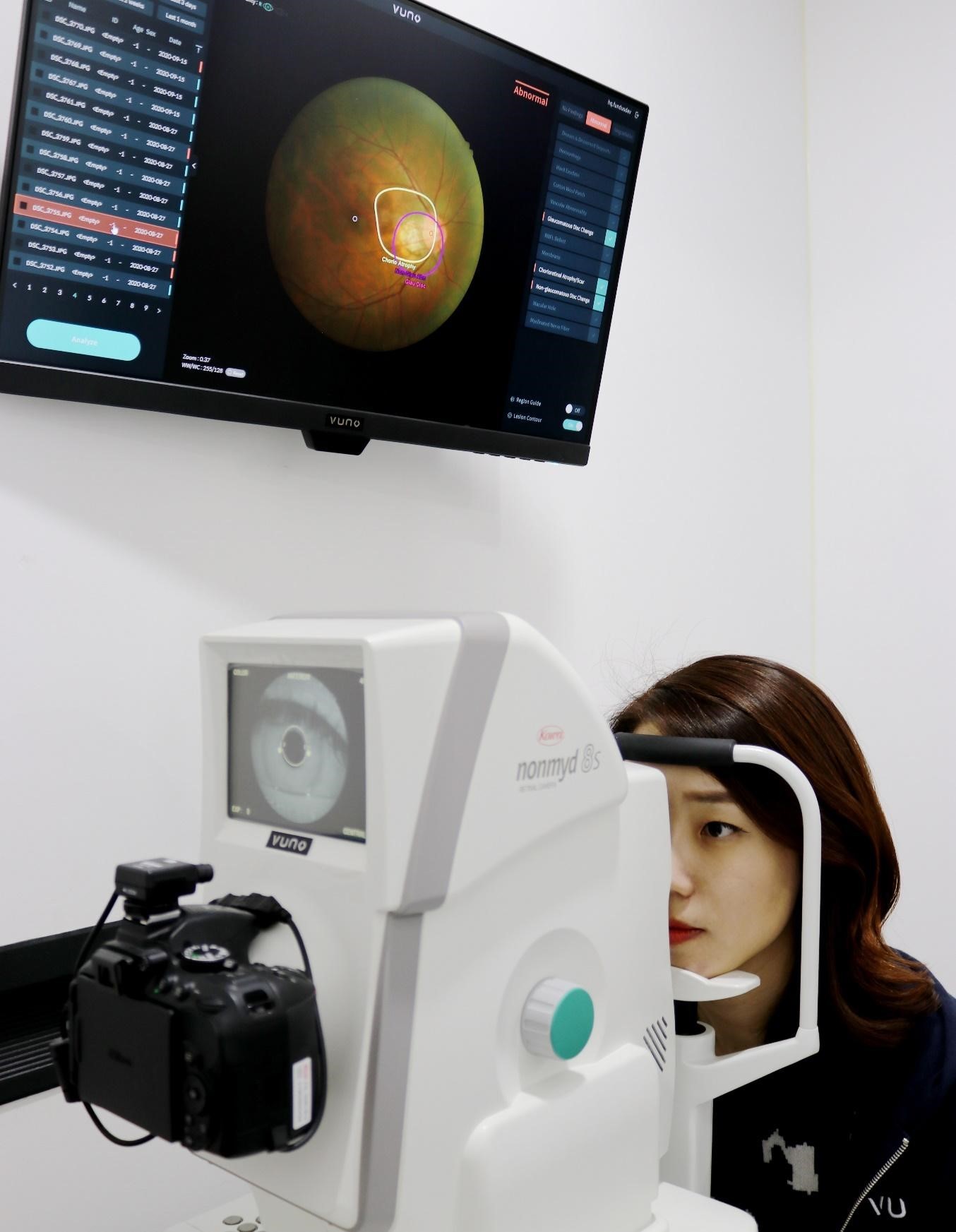 VUNO Ranked 1st at REFUGE2 (MICCAI 2020) - VUNO, View the Invisible ...