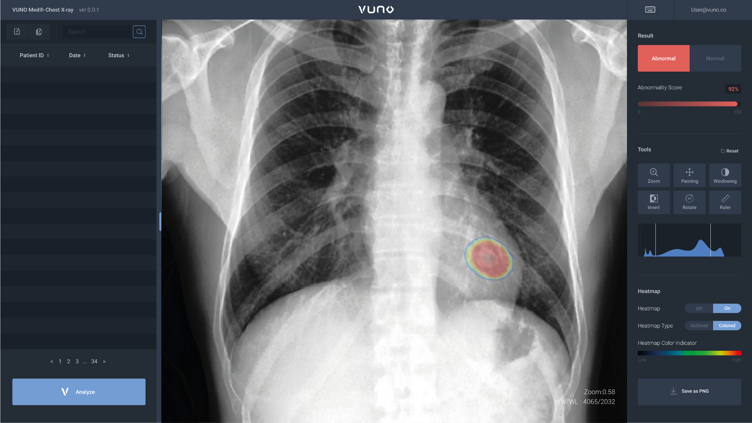 뷰노메드 체스트 X레이 식약처 인허가 획득 - 뷰노, View the Invisible, Know the Unknown