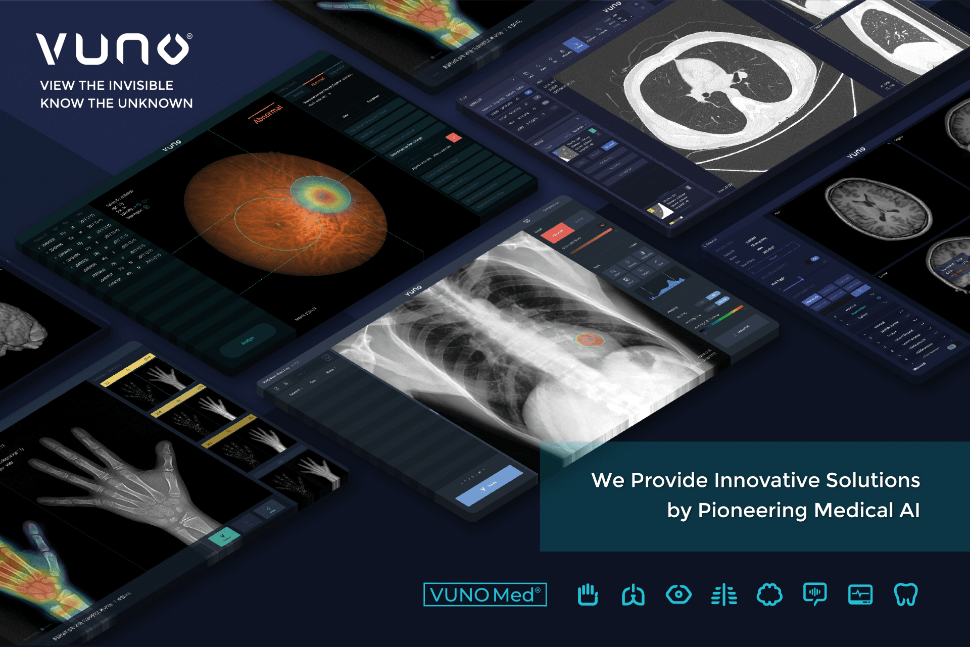 VUNO Is Selected to Build and Demonstrate AI-based Medical Solution in ...