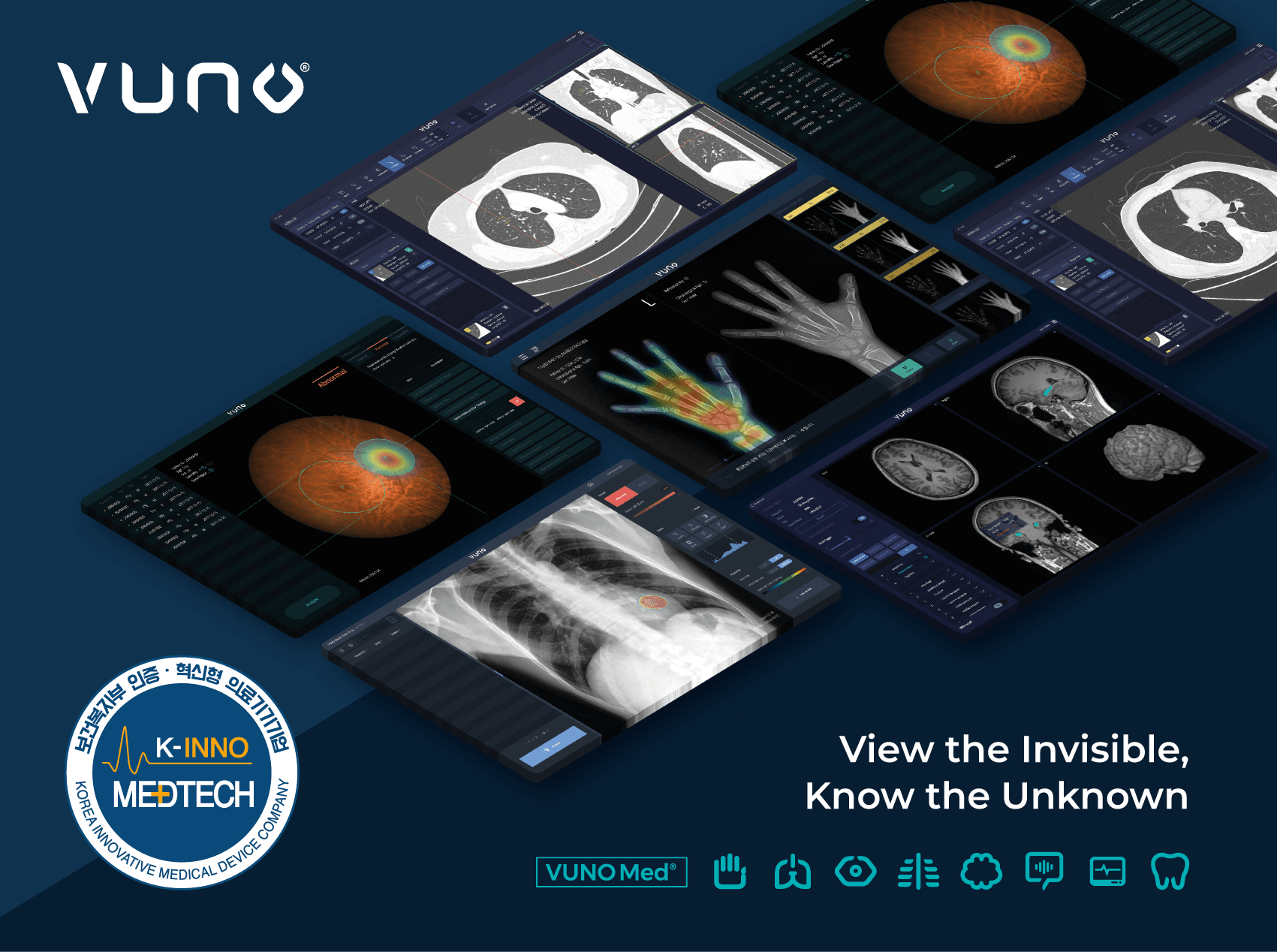 VUNO Selected as a Korea Innovative Medical Device Company - VUNO, View ...