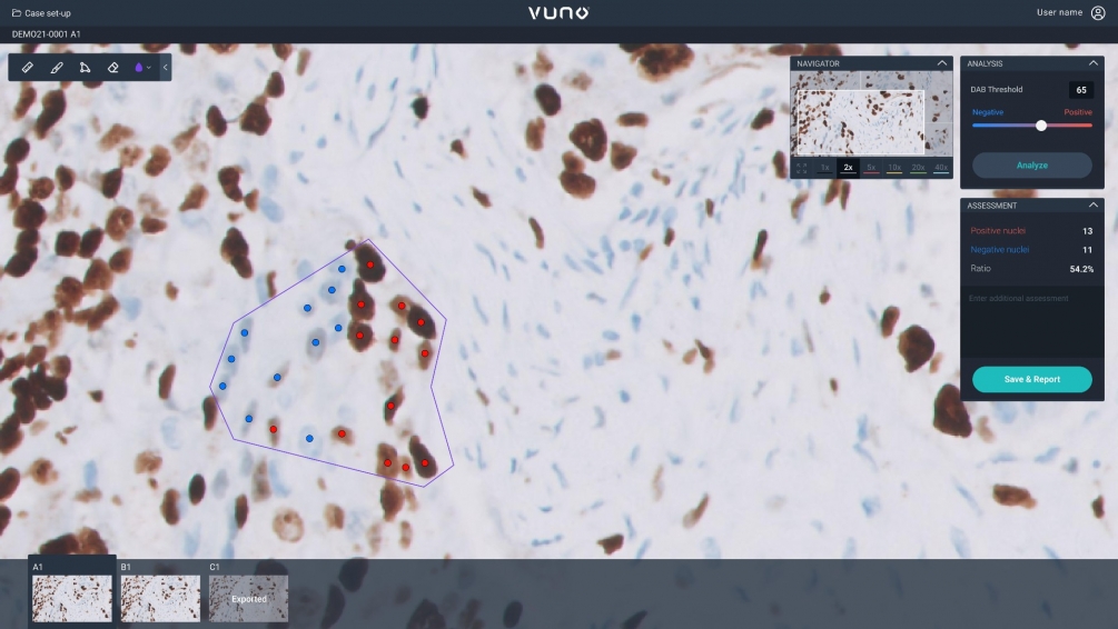 뷰노, 디지털 병리 분석 AI 솔루션 ‘뷰노메드 패스퀀트™’ 식약처 인증 획득 - 뷰노, View the Invisible ...