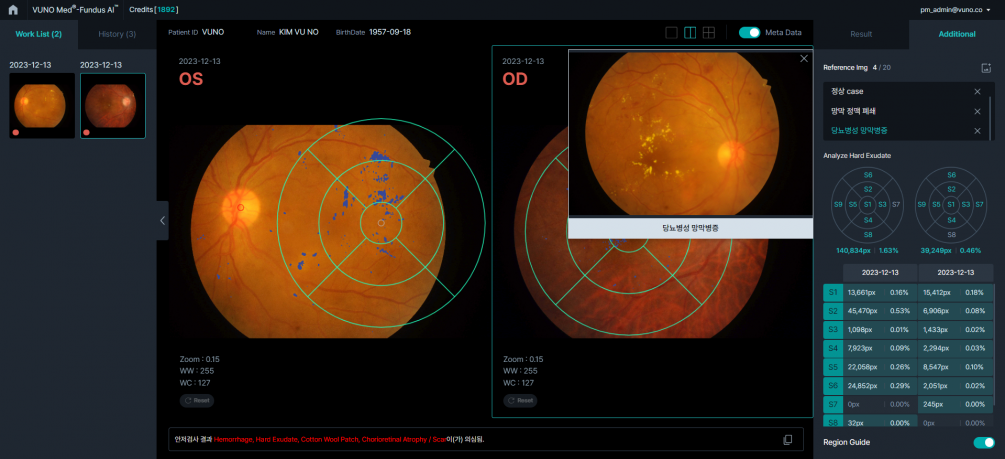 뷰노, 국제 의료AI 경진대회서 1위…녹내장 판독 글로벌 경쟁력 입증 - 뷰노, View the Invisible, Know the Unknown